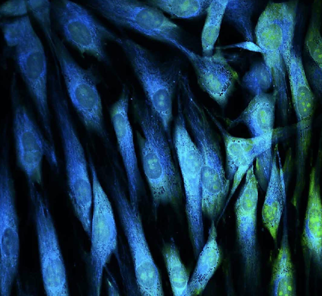 a4cell nanodevices. Lab in a cell devices