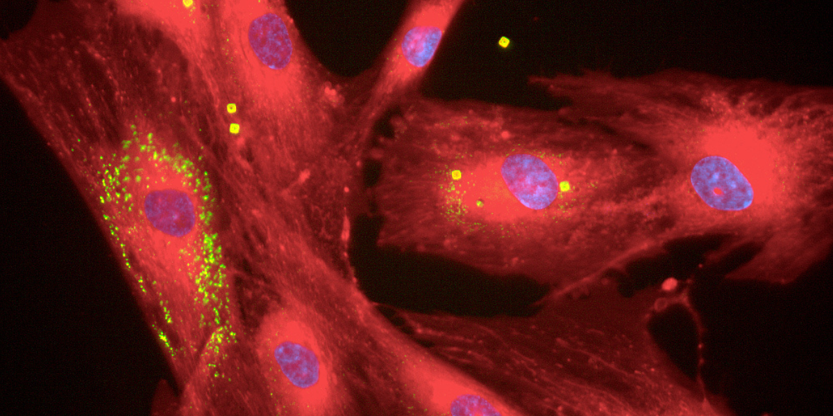 SPAchip®: intracellular living sensors. - a4cell