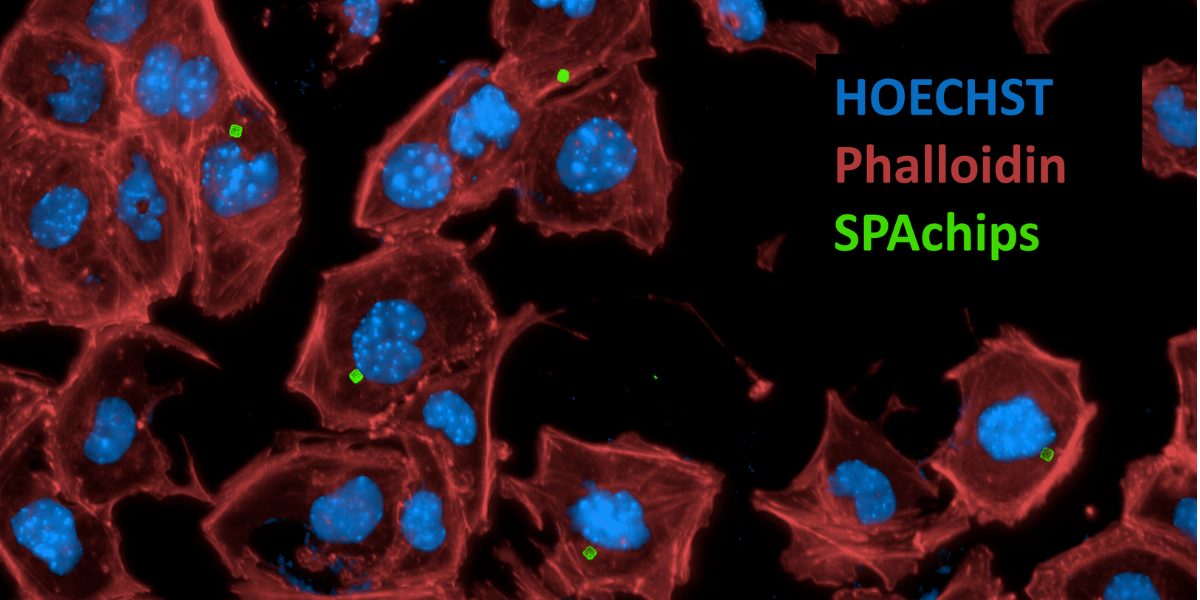 A4liveCell Blog#3: "SPAchip® technology enables the study of calcium signaling in receptor ...