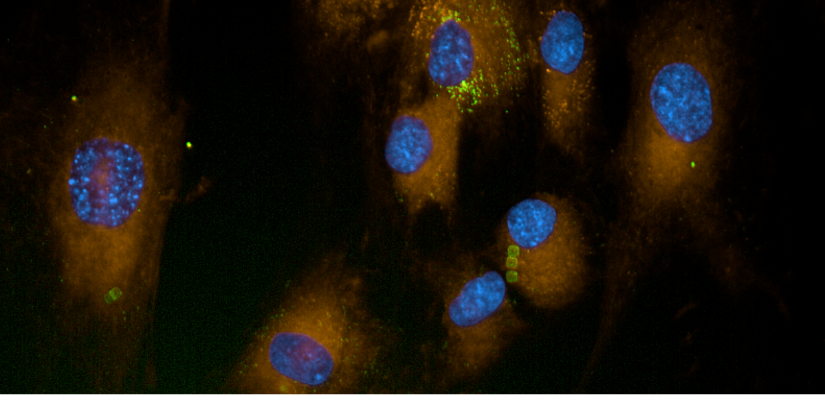 Investigating Reactive Oxygen Species (ROS) in fibroblast cells using ...