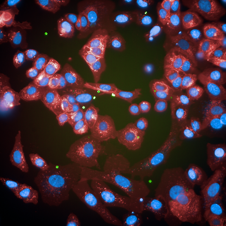 CytoCHECK SPAchip® Calcium Single-Detection Kit - a4cell